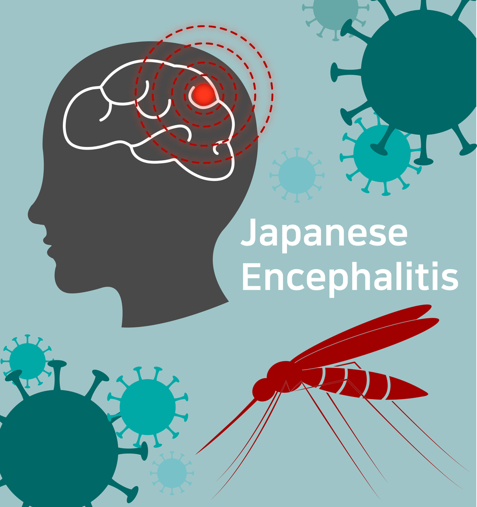 Instructions for Japanese Encephalitis Vaccination 日本腦炎疫苗接種後須知 | 衛教單張 ...