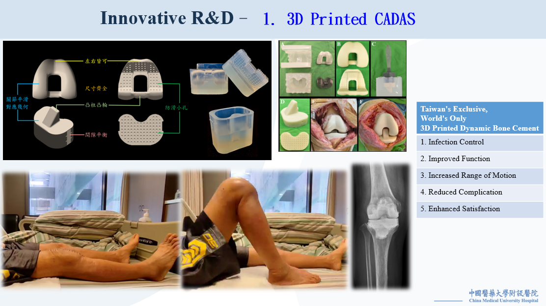 3D Printed CADAS | 骨科部 - 中國醫藥大學附設醫院