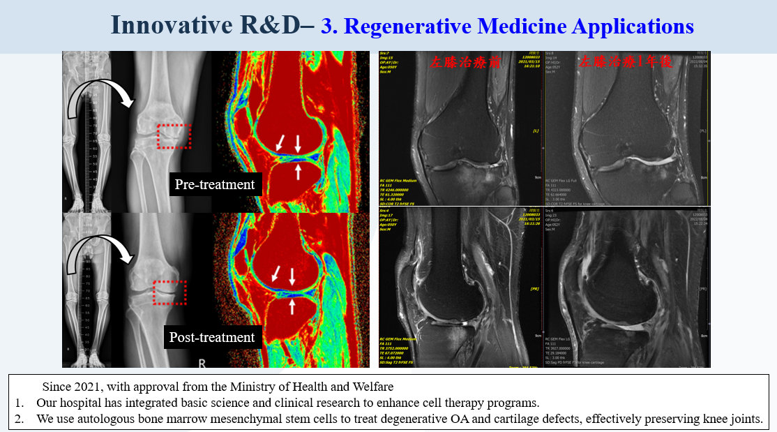 Regenerative Medicine Applications | Orthopedics - China Medical ...