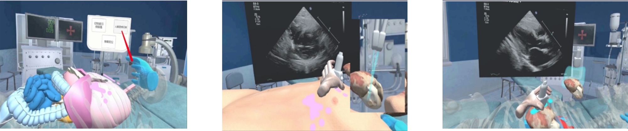 Cardiac VR Digital Imaging – Immersive Ultrasound Simulation Teaching ...