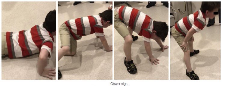 孩子平衡變差、容易跌倒，是有感覺統合障礙嗎？ - 中國醫藥大學兒童醫院 - cmuch.org.tw